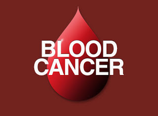 Blood cancer Symptoms, Types and Treatment | Science online