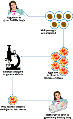 Embryo Screening (PGD) for Genetic Diseases advantages & disadvantages ...