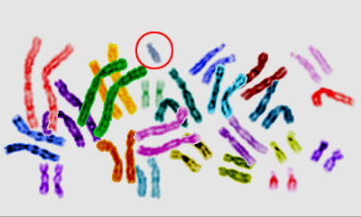 Human karyotype, Chromosomes and Genetic information | Science online