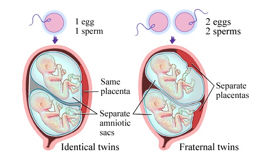 Childbirth, lactation, types of twins, problems related to child ...