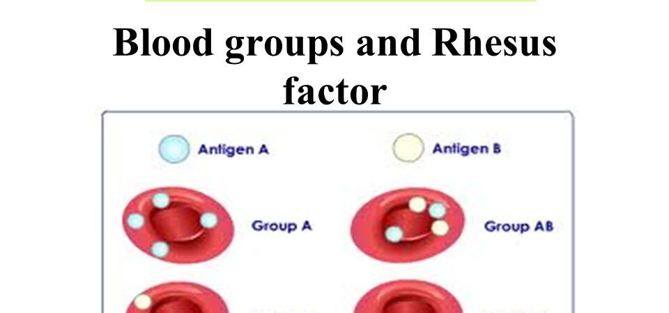Blood transfusion causes, Haemolytic transfusion reaction & Acute renal ...
