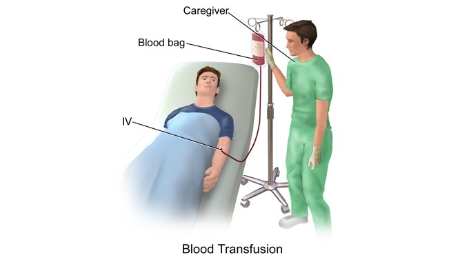 Blood transfusion causes, Haemolytic transfusion reaction & Acute renal ...